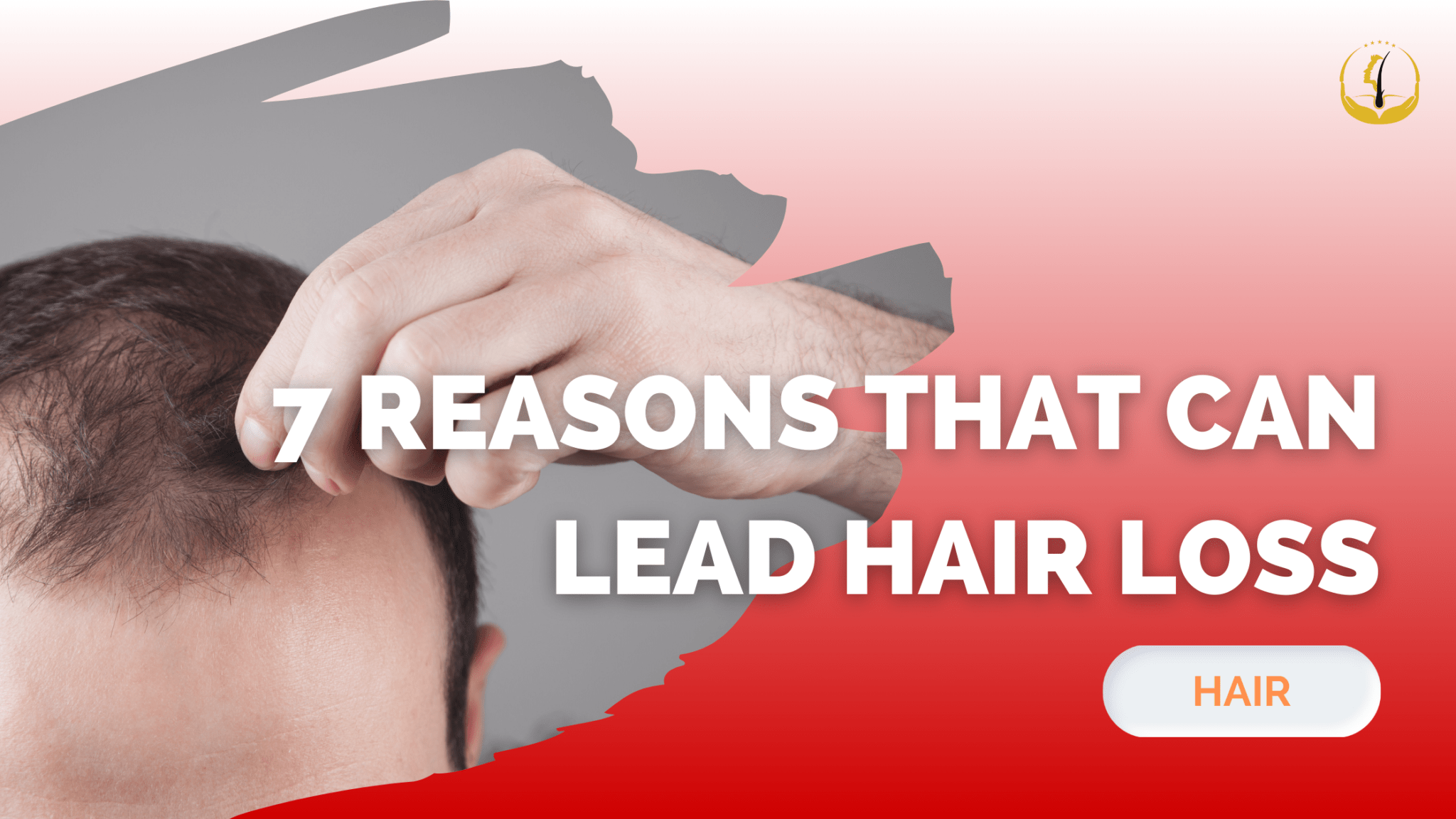 7 Reasons That Can Lead Hair Loss | Glojas Hair Transplant, Aesthetic ...