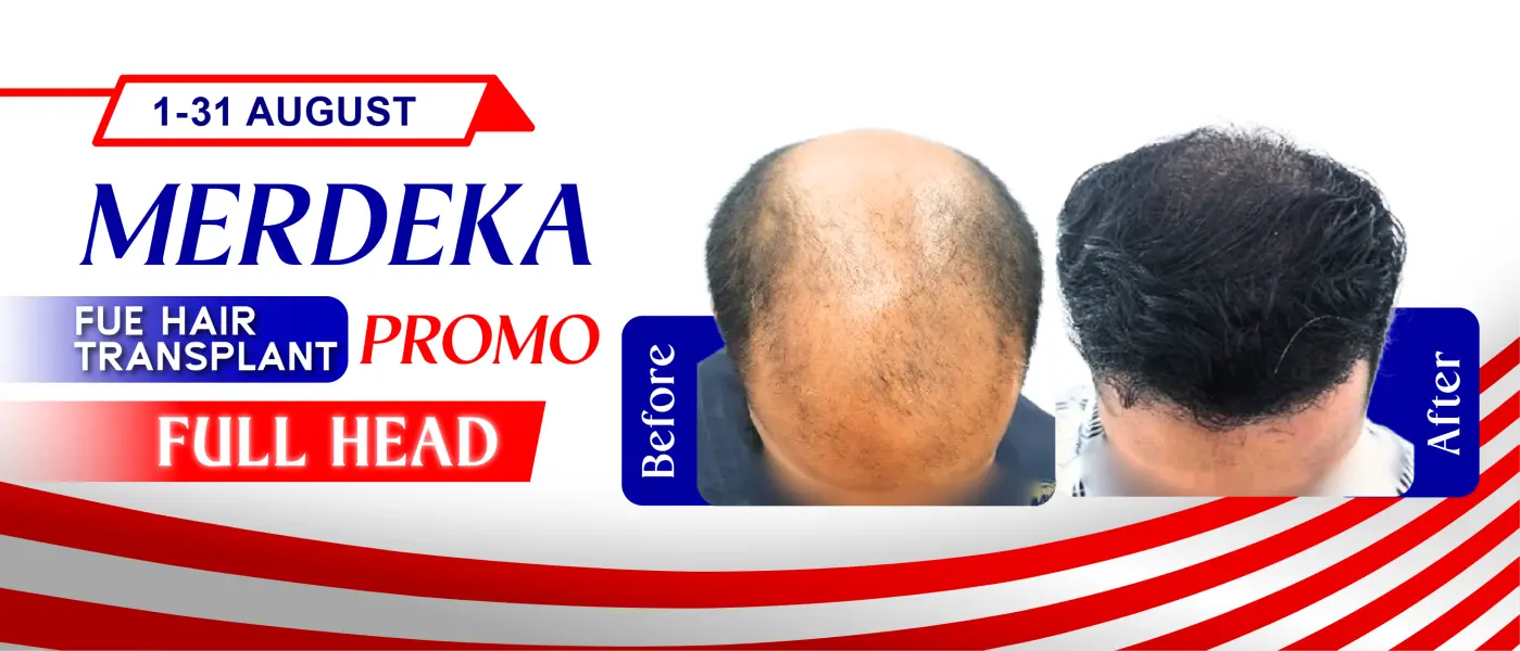 Hair Transplant Specialist, Aesthetic Clinic | Malaysia