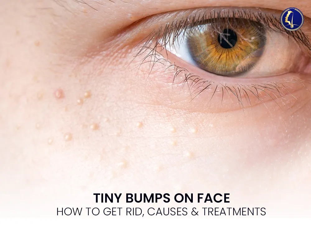 Tiny Bumps On Face What Treatment Suitable In 2025